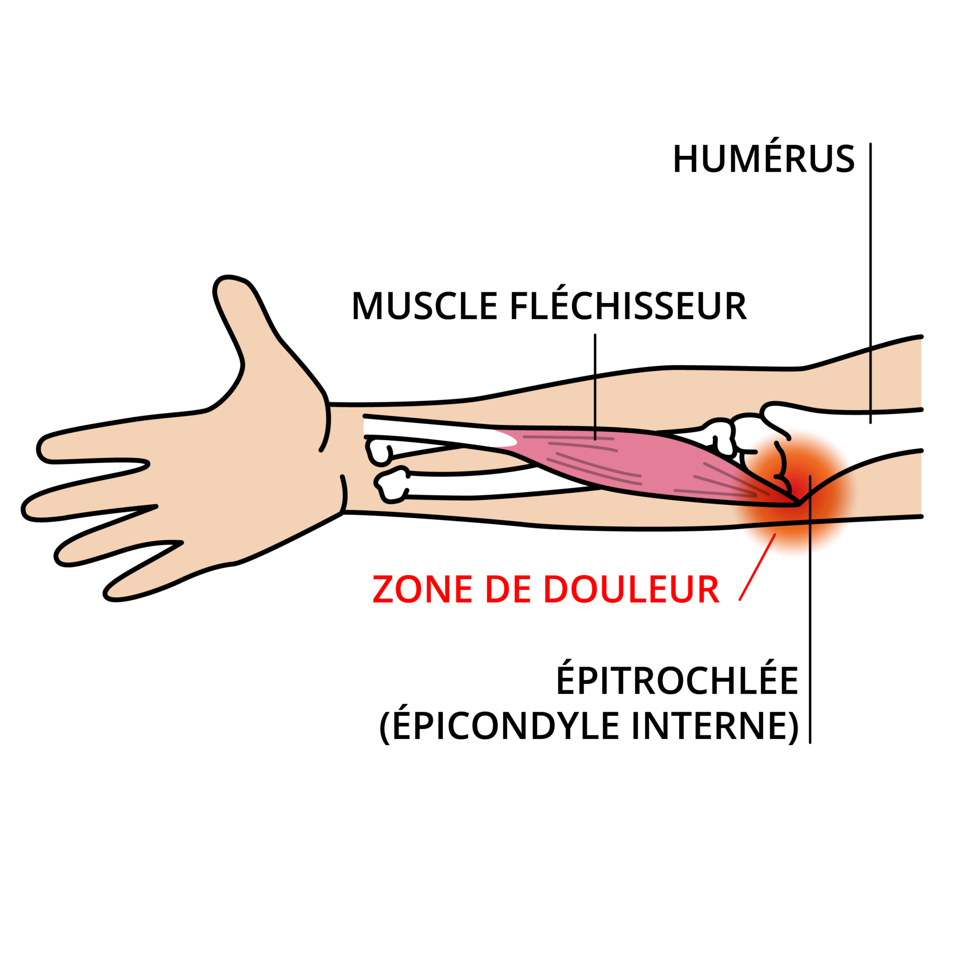 Les pathologies du coude - Velpeau